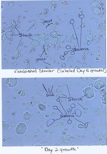 yeast under microscope labeled